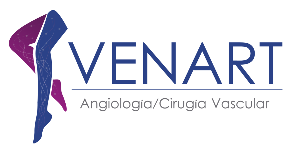 Tratamiento de Várices | Cirugía Cardiovascular | Clínica Venart Ags